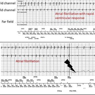 The Illustration Shows The Four Phases Of Sexual Intercourse And The Download Scientific
