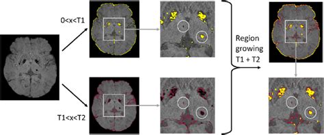 Segmentation Of The Exemplary Image Using Mimseg Based Adaptive Download Scientific Diagram