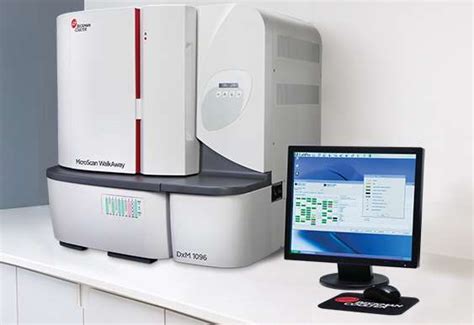 Early Sepsis Detection Workflow Revolutionize Lab Results