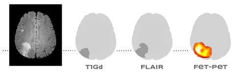 An Illustration Of The Imaging Information Used For Bayesian Model Download Scientific Diagram