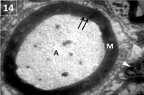 Transmission Electron Micrograph Of The Sciatic Nerve Of A 20 Day Old