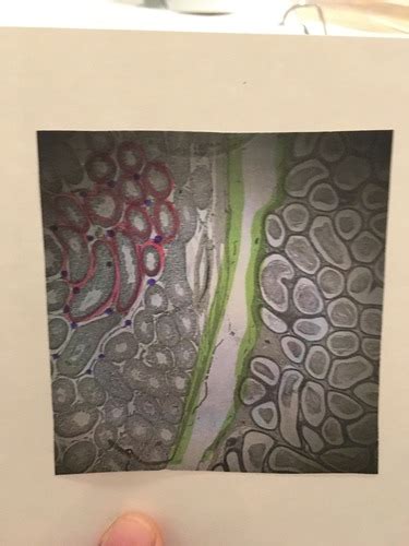 Testis Flashcards Quizlet