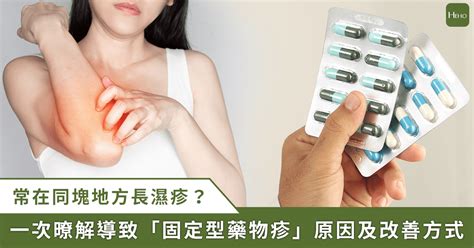 身上總固定位置瘀青長斑塊醫籲吃藥後出現這狀況要注意 Heho健康