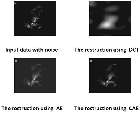 Figure 1 From Denoising Convolutional Autoencoder Based B Mode