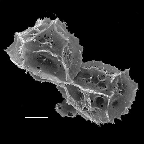 Asplenium Rhizophyllum Aspleniaceae