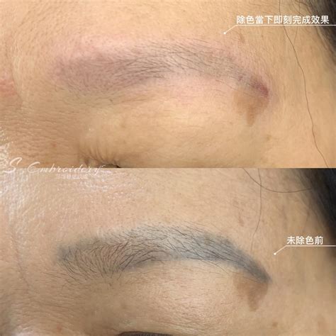 💫除色案例分享大公開 對比照分享給大家 不管是橘眉紅眉，還是藍眉青眉 除色當下即刻完成效果，差很大 顏色上明顯變淡很多 不僅一掃顏色也一掃尷尬🧹 😫眉毛做壞實在不想示人 😫後期留下的橘眉紅眉