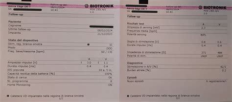 Carlo De Innocentiis On Linkedin Conduction System Pacing Csp In