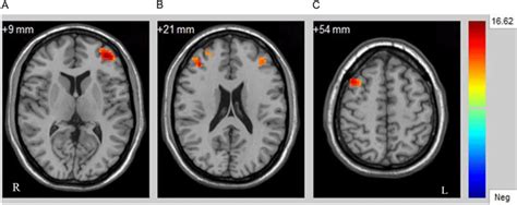 Ventrolateral Prefrontal Cortex