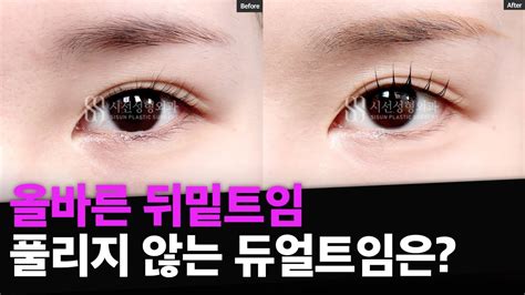 올바른 뒤밑트임 풀리지 않는 듀얼트임후기 Youtube