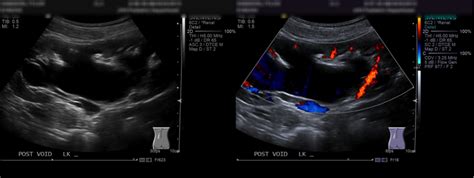 Sagittal Ultrasound Images