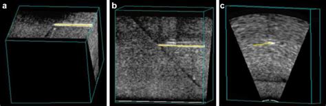 Example Of Needle Segmentation Results During Insertion Of A Needle Download Scientific Diagram