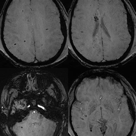 Phase Image Of The Dentate Nucleus Download Scientific Diagram