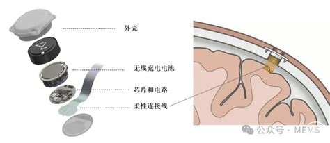Bci T 基于mems超声波方案的无线植入式脑机接口技术 脑医汇