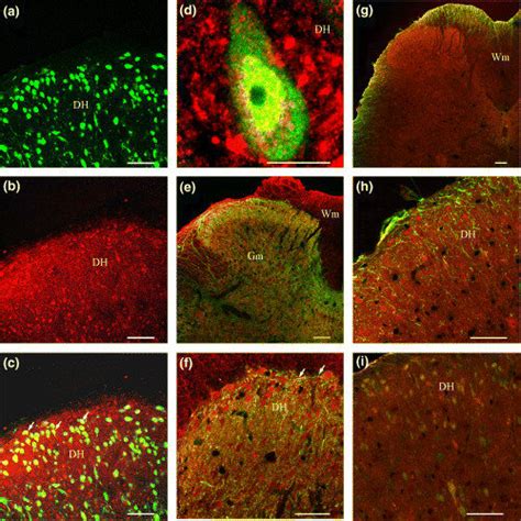 Dual Channel Confocal Laser Scanning Microscope Photomicrographs Of
