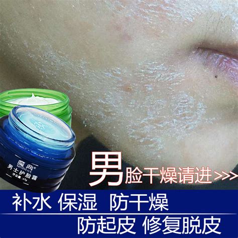 男脸上皮肤干燥脱皮起皮脸部修复起干皮护肤品脸霜防裂秋冬防护霜 虎窝淘