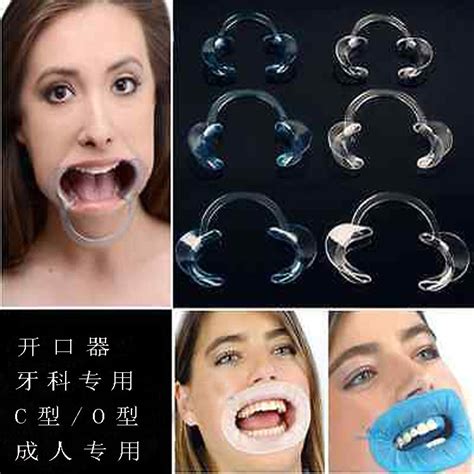 厂家直销 C型开口器 正畸开口器 口腔专用牙齿美白牙科器材 阿里巴巴