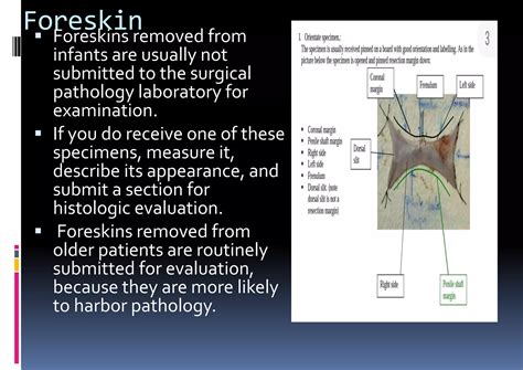Hpe Grossing Of Penectomy Pptx