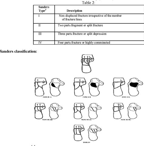 Calcaneus Fracture Classification