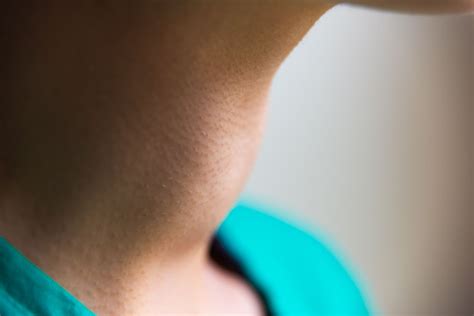 Multinodular Goiter An Enlarged Thyroid Gland Causes Diagnosis And Treatment Options Medagg