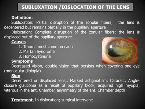 Eye Lens Dislocation Symptoms At Kathleen States Blog