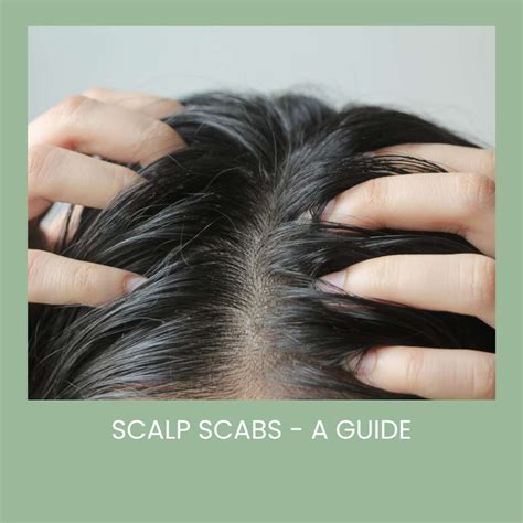 Scalp Scabs A Guide Odylique