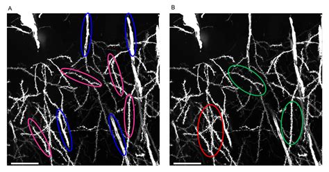 Dendritic Spine Quantification Using An Automatic Three Dimensional Neuron Reconstruction