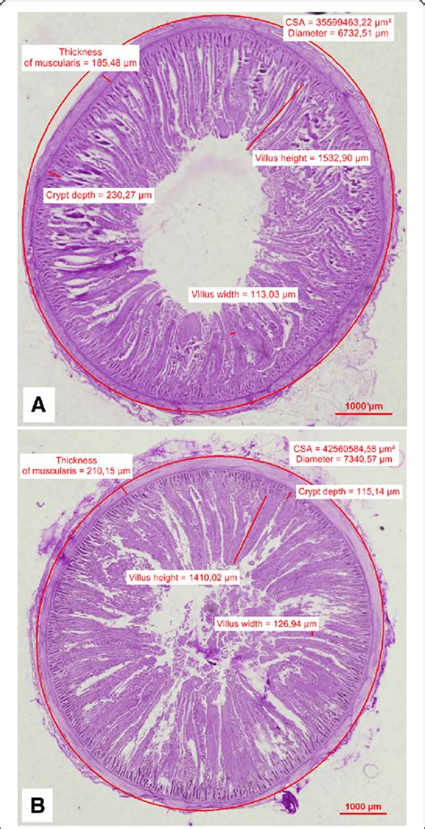 A Photomicrograph Light Microscope Of The Duodenum Csa Diameter