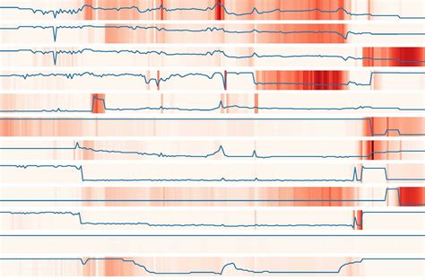 Dynamic Predictions Of Postoperative Complications From Explainable