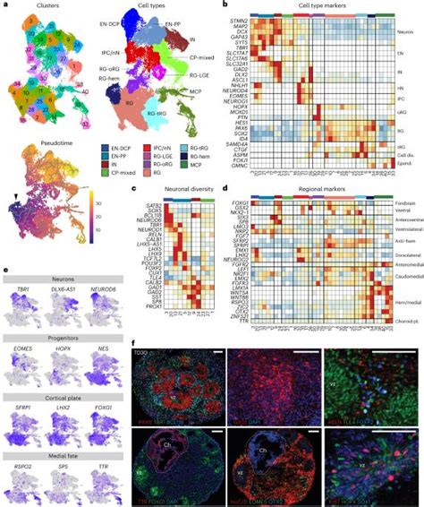 Modeling Idiopathic Autism In Forebrain Organoids Reveals An Imbalance