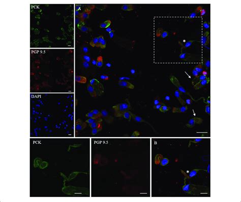 Distribution Pattern Of Pgp 95 And Pck Pgp 95 Red Shows A Dotted