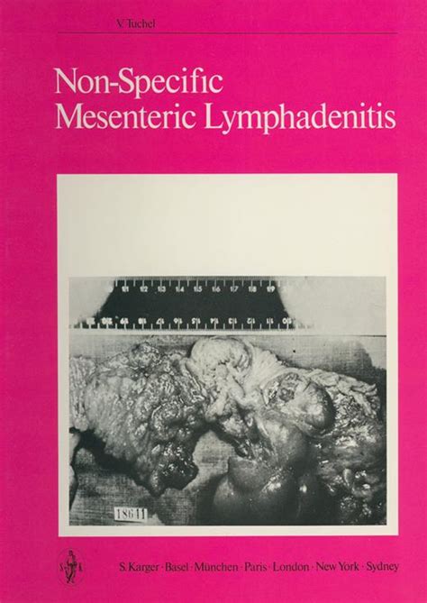 Vii Mesenteric Lymphadenitis Terminal Lymphoid Ileitis And Crohns Disease Non Specific