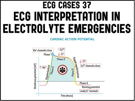 Ecg Interpretation
