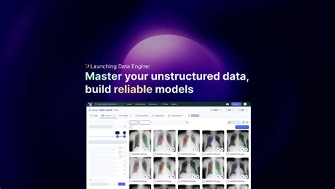 Launching Data Engine Manage And Improve Your Unstructured Datasets