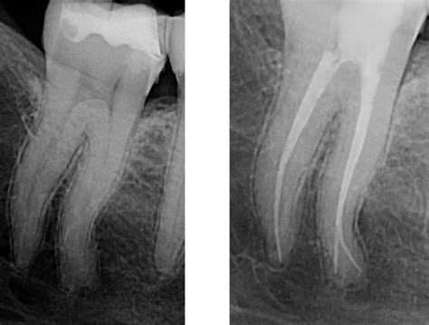 Oscillation On Its Own And As A Means To Make Rotary Safe