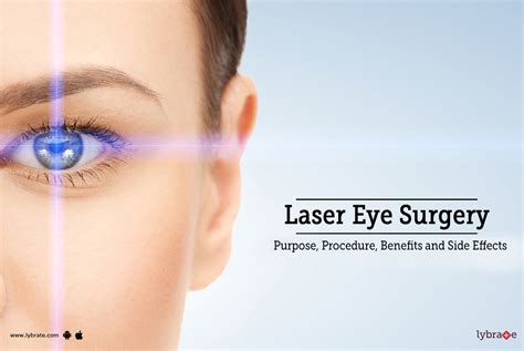Laser Eye Surgery Purpose Procedure Benefits And Side Effects