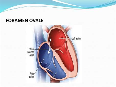 Fetal Circulation Pptx