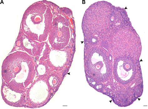 A Comparative Histo Architecture Of Mouse Ovary During Normal Estrus