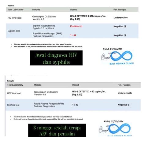 Pasien Didiagnosa Dengan Hiv Positive Dan Syphilis Positive Pada