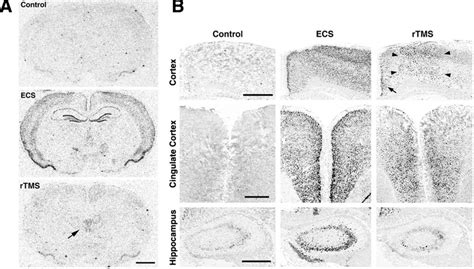 A Expression Of C Fos Mrna In Adult Rat Brain After Ecs And Rtms