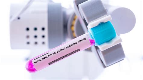 Гонадотропин освобождаващ хормон какво представлява