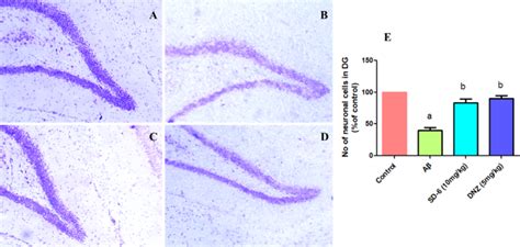 Histomorphological Representation Dentate Gyrus Dg Region Of Brain