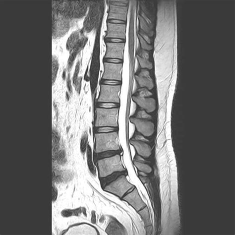 โปรแกรมเมอร์ กับ สุขภาพที่ต้องระวัง By Nutnicha Meesuk Ascend Developers