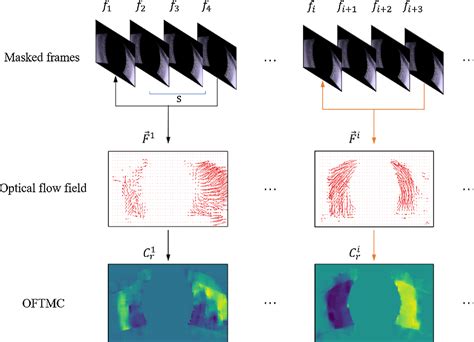 Figure 9 From Deep Learning Based Torsional Nystagmus Detection For Dizziness And Vertigo