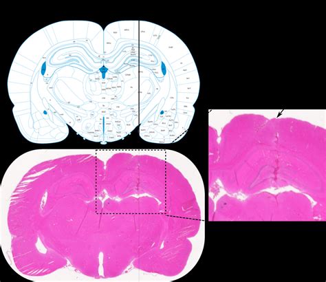 22 Comparison Between Histological Rat Brain Slice And Rat Brain Atlas