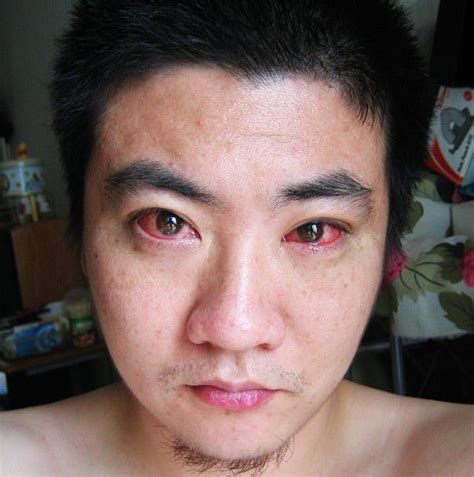 看手机眼睛坏了的图片玩手机眼睛瞎了图片眼睛打针图片大山谷图库