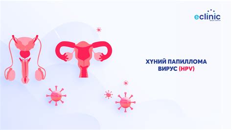 Хүний папиллома вирус