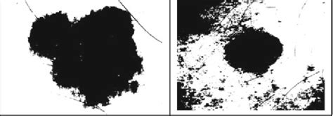 Segmentation Of Sample Dermoscopic Images Download Scientific Diagram