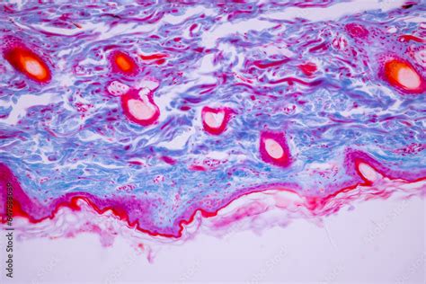 Backgrounds Of Characteristics Tissue Of Human Scalp Skin Human From General Body Surface And