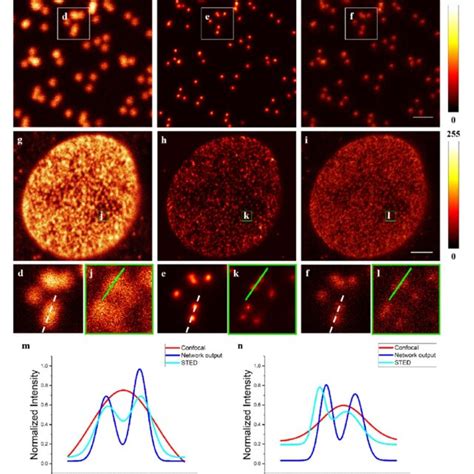 Super Resolution Imaging Of The Nano Beads And Nucleus Using Tcan A