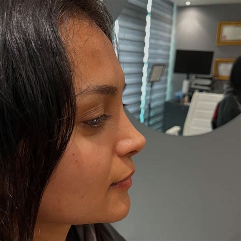 What Is The Most Attractive Nose Shape Opdr Umit Kucuktepe
